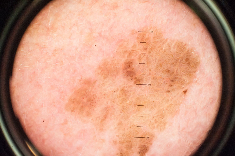 Our Services and Prices – Mole Screen